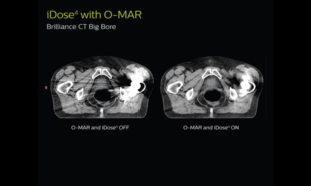 CT Big Bore – Ascend Imaging