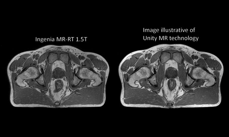 MR-linac – Ascend Imaging