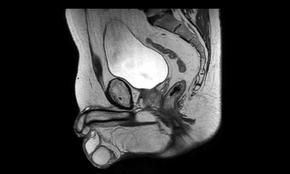 RTdrive MR Prostate – Ascend Imaging