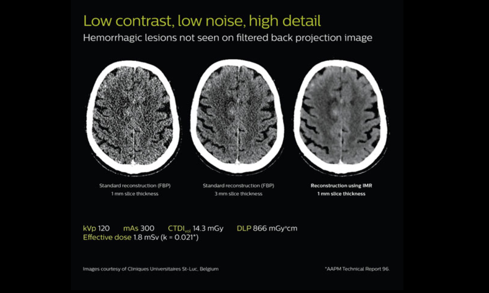 iCT Family – Ascend Imaging
